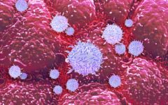 Ferric maltol: new iron therapy for patients with inflammatory bowel ...