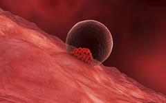 New MIMS table comparing levonorgestrel-releasing intrauterine systems ...