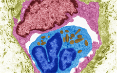 New injectable antibody treatment for asthma | MIMS online