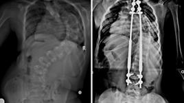 Ellipse Technologies relates human story behind medical device | PR Week