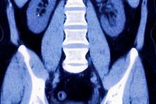 The basics - Loin pain | GPonline