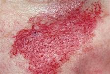 Vascular conditions: differential diagnosis | GPonline