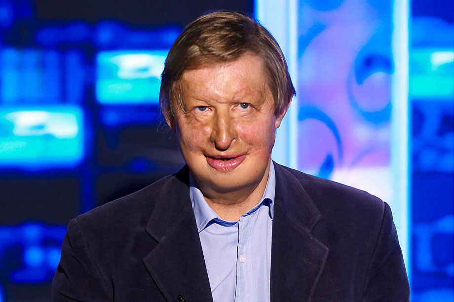 Up to 12 jobs could go at Changing Faces, run by James Partridge ...