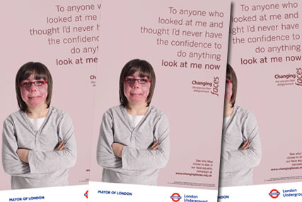 Changing Faces launches campaign to destigmatise facial disfigurement
