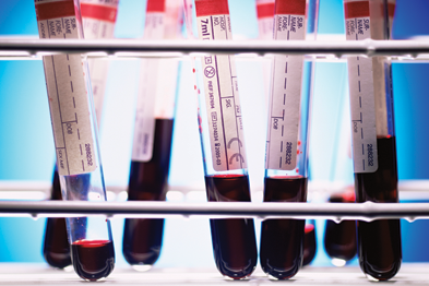 Exclusive: CCGs can save £750m on tests | GPonline