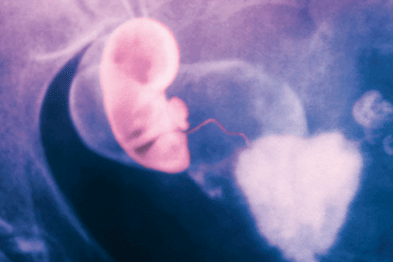 Chlamydia link to ectopic pregnancy risk explained | GPonline