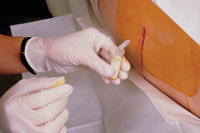 Case study - An unexpected development following a minor head injury ...