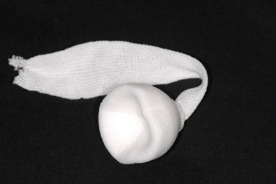 Clinical pictures: Perianal problems | GPonline