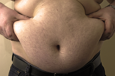 Stomach fat 'greatest risk to heart' | GPonline