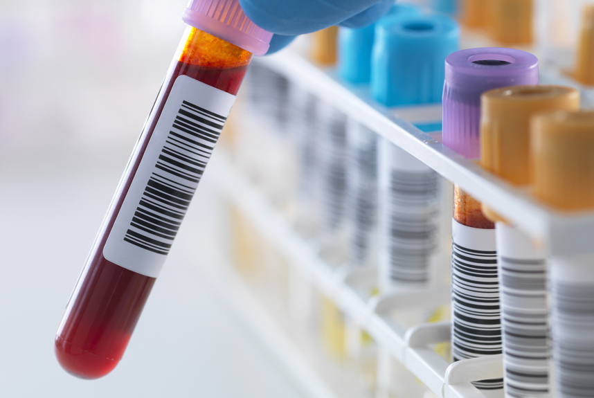 NICE backs first long-acting injectable treatment for HIV | GPonline