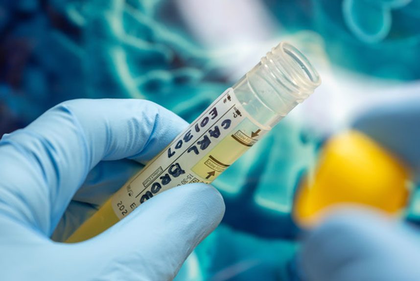 Abnormal vaginal discharge - red flag symptoms | GPonline