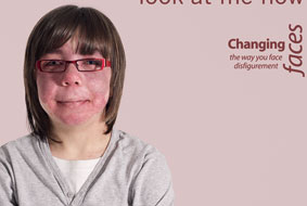 Changing Faces Advertising, Marketing Campaigns and Videos