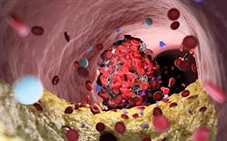 Hyperlipidaemia | MIMS online