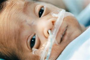 Clinical Review - Bronchiolitis in children | GPonline