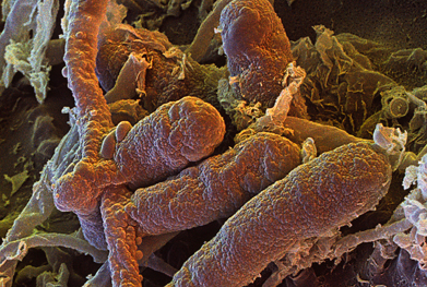 Micetal topical antifungal cream | MIMS online