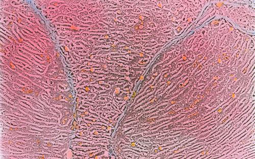 Low-dose oestrogen pessary for vaginal menopause symptoms | MIMS online