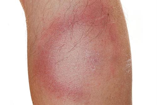 Red flag symptoms and clinical signs | GPonline