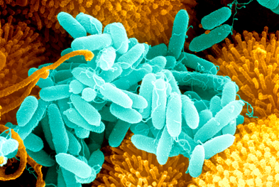 Cayston now indicated from six years | MIMS online