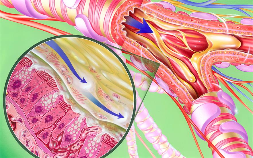 Symbicort now available as metered-dose inhaler for COPD | MIMS online