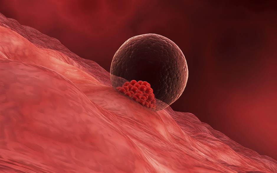 Contraceptive devices | MIMS online