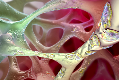 New prescribing advice for Protelos | MIMS online