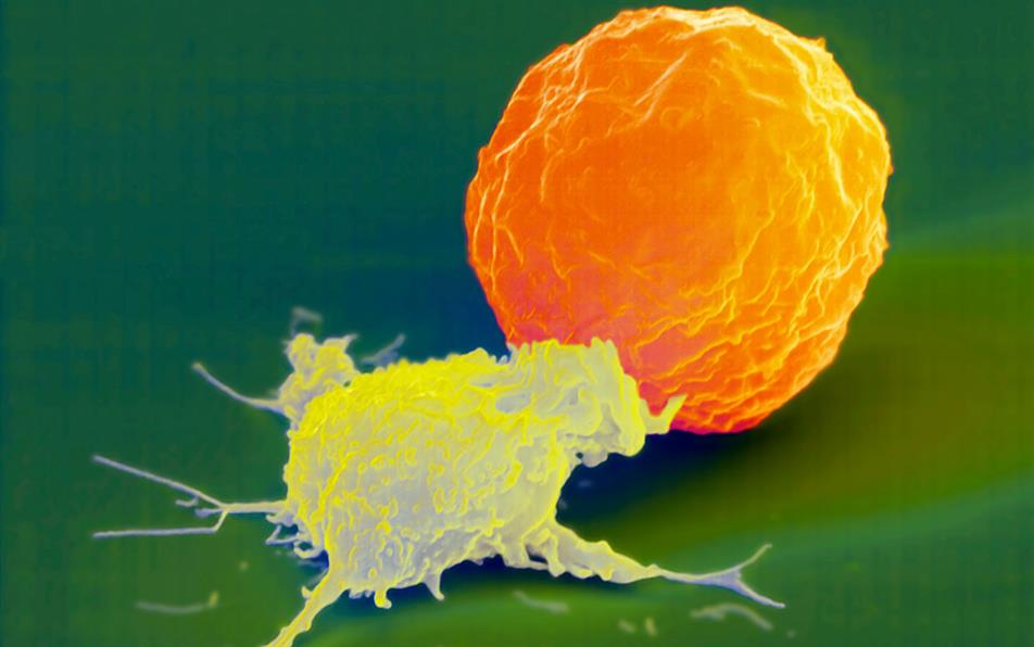 Elotuzumab: new immune-stimulating myeloma treatment | MIMS online