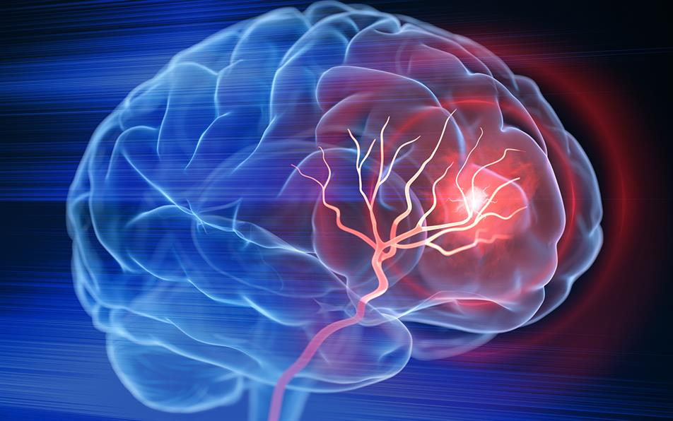 NICE recommends genetic testing for clopidogrel suitability | MIMS online