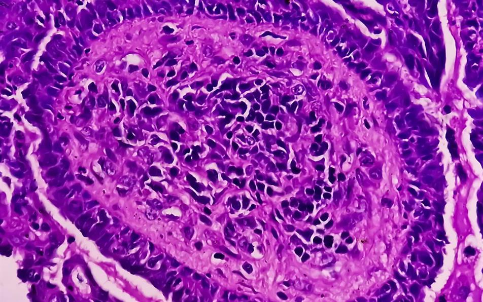 HRT safety alert highlights excessive oestrogen dosing | MIMS online