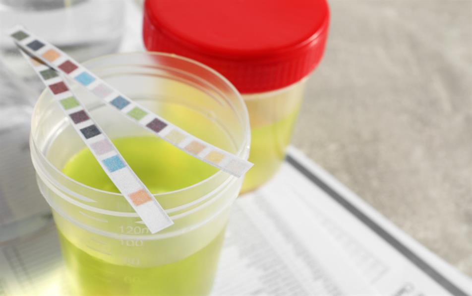 New MIMS table outlines antibiotic regimens for UTI | MIMS online