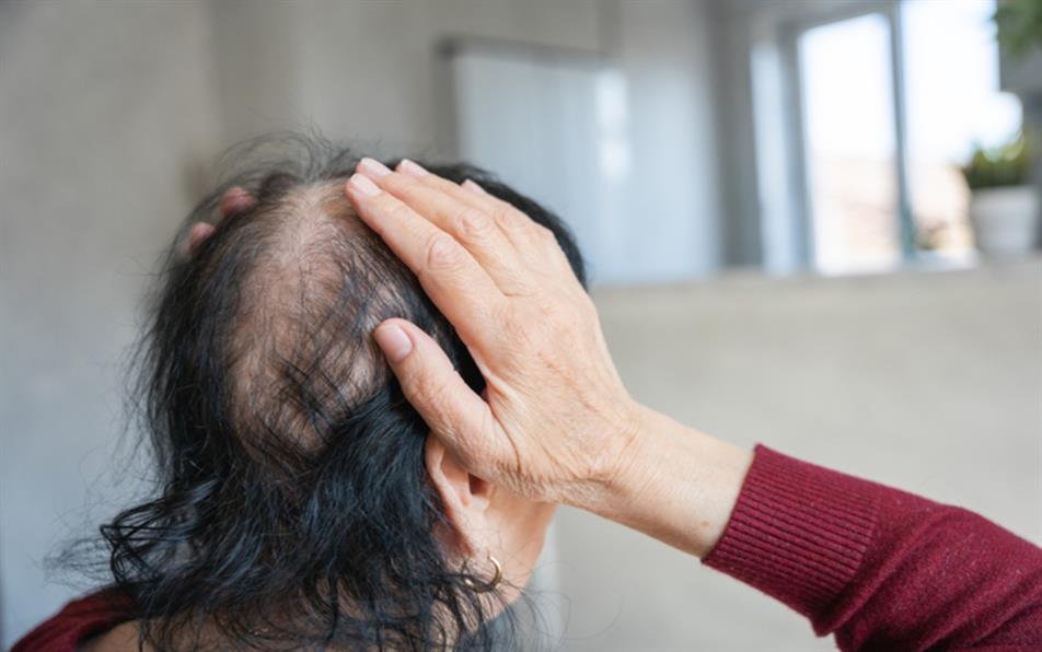 Guidelines from Primary Care Dermatology Society now available on MIMS ...