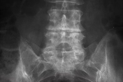 The basics - Addison's disease | GPonline