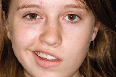 Case Study - Young patient with facial weakness | GPonline