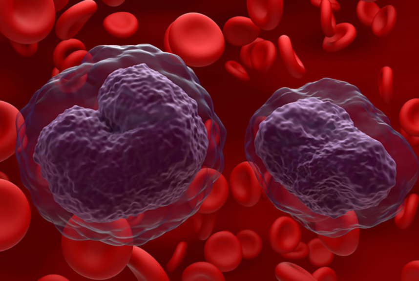 Lymphoma - red flag symptoms | GPonline